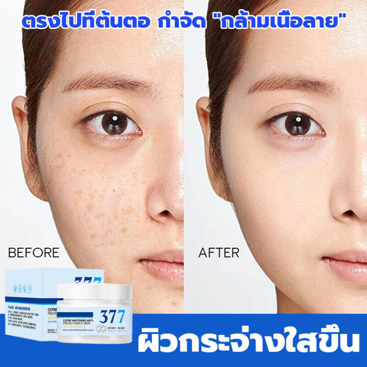 Dinkiss ครีมทาฝ้า 50g ครีมบำรุงผิวหน้า ไวท์เทนนิ่งครีม ซ่อมแซมผิวหนัง ...