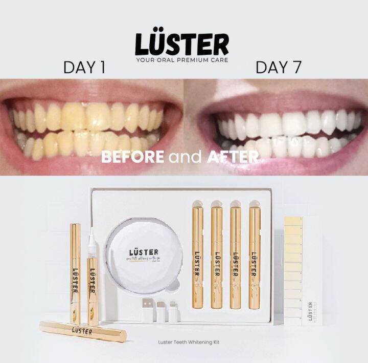 Luster Teeth Whitening Kit (FDA APPROVED) | Lazada PH