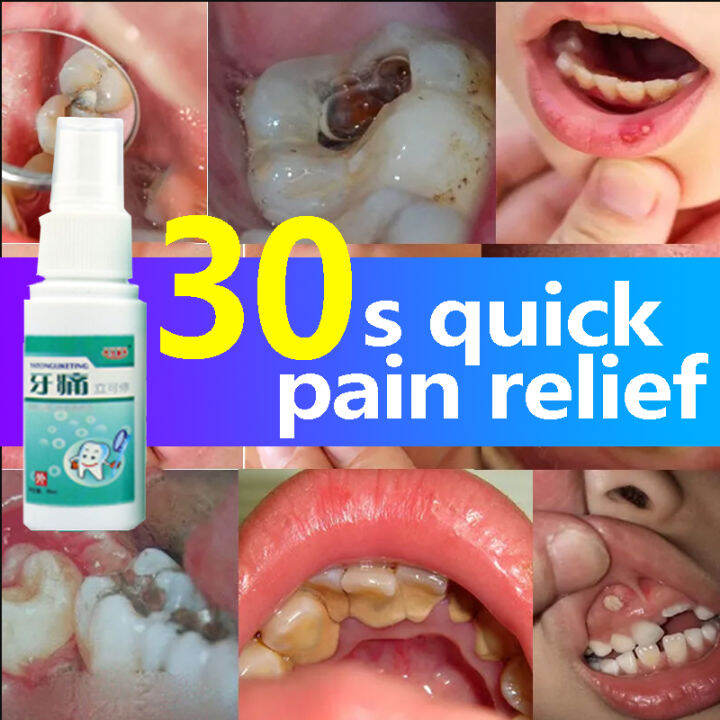 Effective Quickly 】Toothache Pain Reliever spray gamot sa sakit ng ...