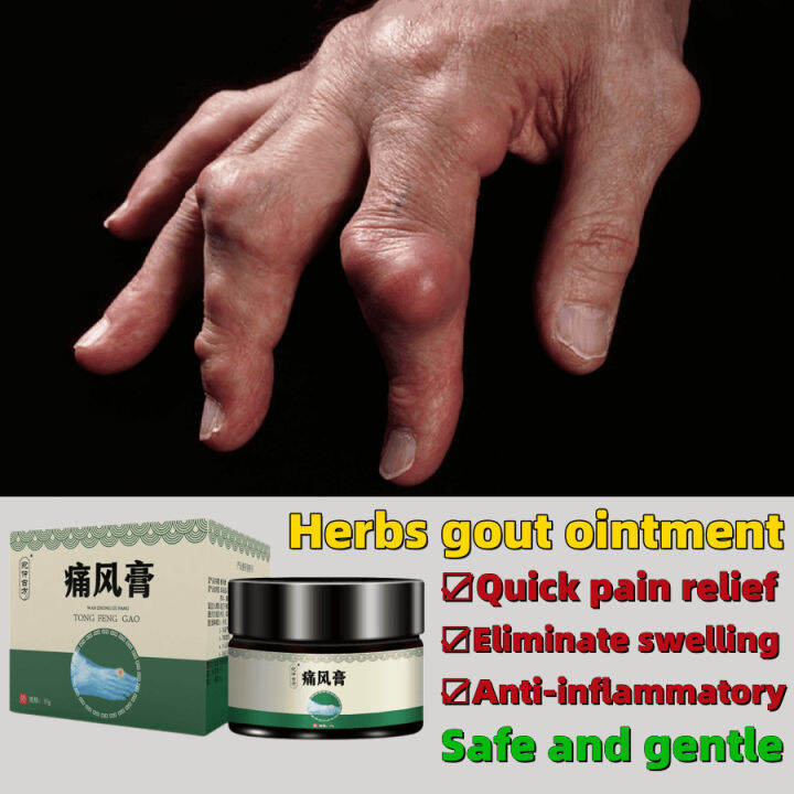 Gout Ointment osteoarthritis joint pain painkiller ubat gout treatment ...