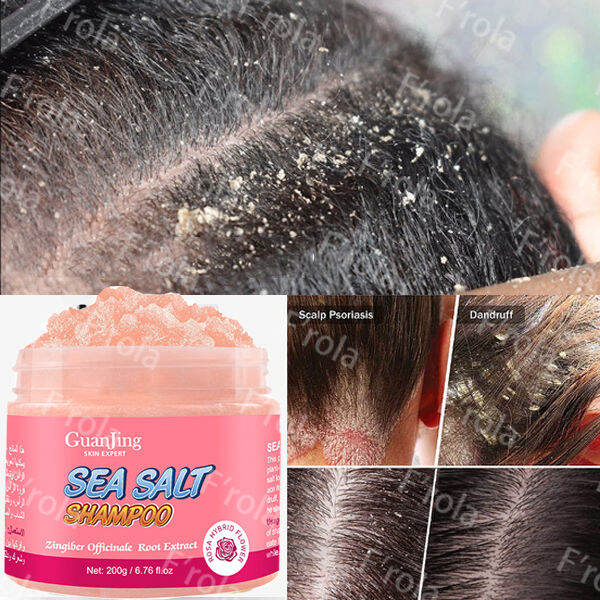 Sea Salt Perfume Shampoo Anti Dandruff Shampoo for Men & Women Scalp ...
