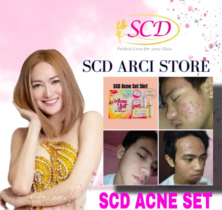 SCD ACNE SET 5in1 | Lazada PH