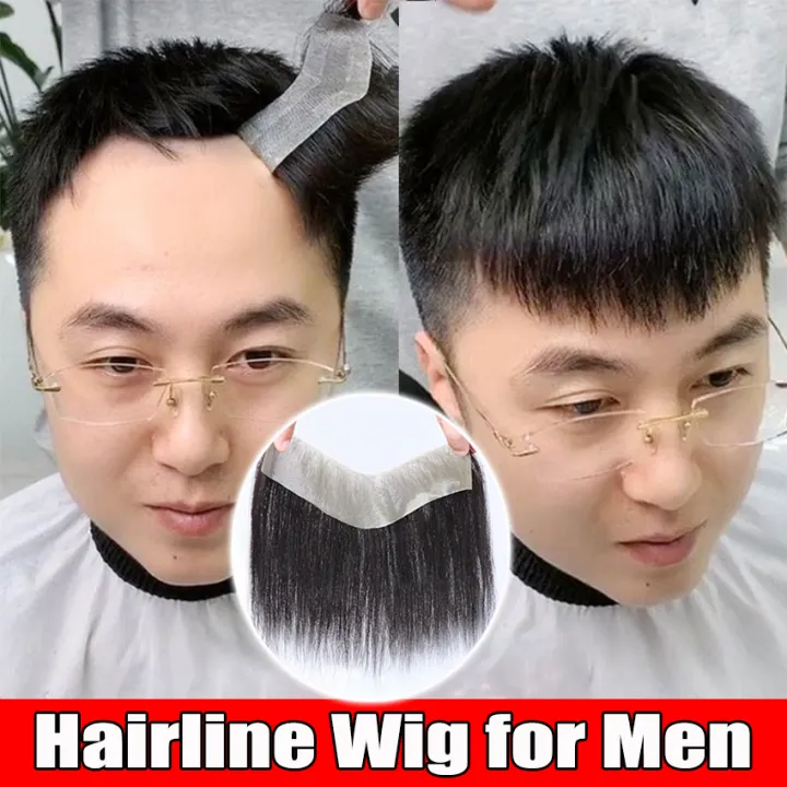 Hairline วิกผมสติกเกอร์ผู้ชายหน้าผากไม่มีรอยต่อชิ้นทดแทนที่มองไม่เห็น M ...