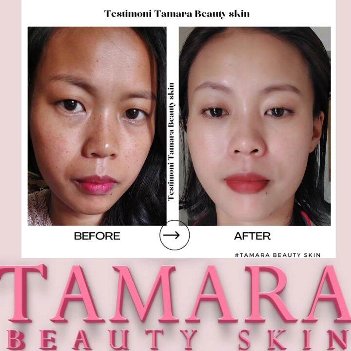 Tamara Beauty Skin Paket Whitening Glowing Flek | Lazada Indonesia