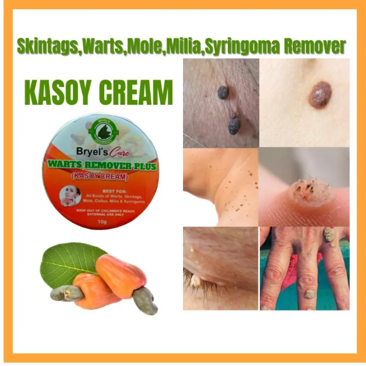 10g PURE AND ORGANIC WART,SKINTAGS,MOLE AND SYRINGOMA REMOVER/KASOY ...