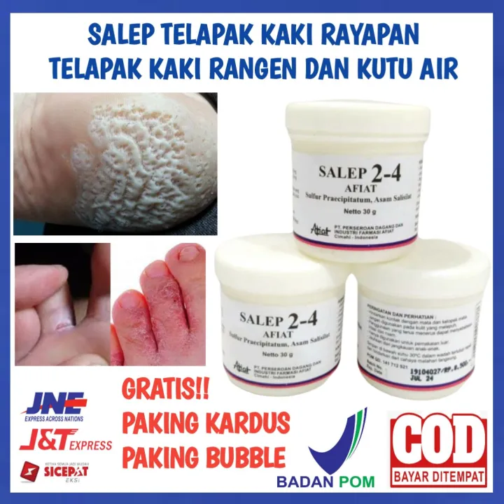 SALEP TELAPAK KAKI RAYAPAN TELAPAK KAKI RANGEN DAN KUTU AIR | Lazada ...