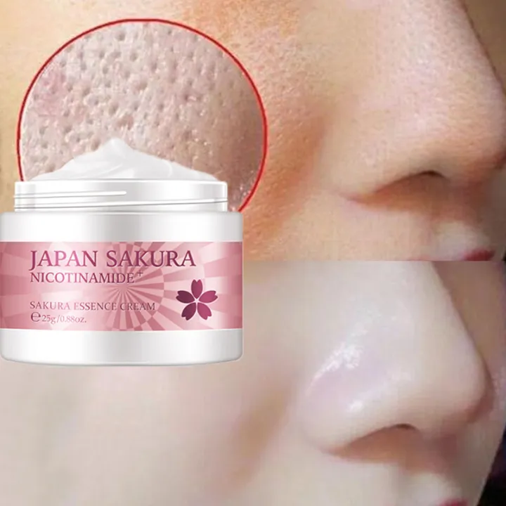 JAPAN SAKURA Whitening Moisturizing Cream freckles remover Acne and ...