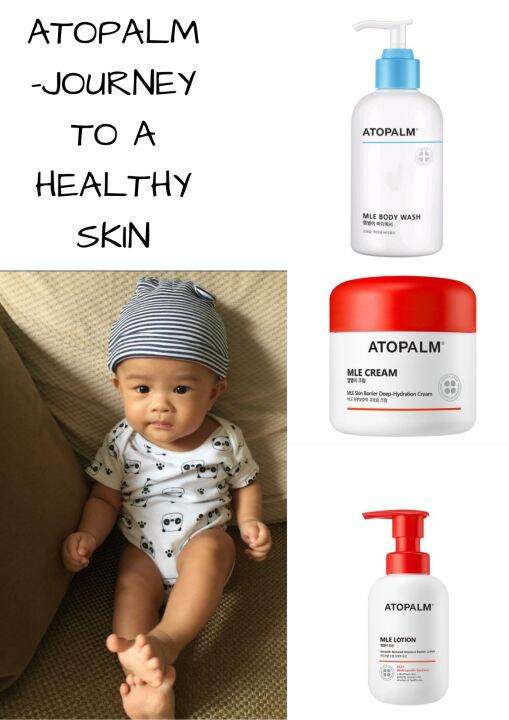 Import From Korea- Atopalm Mle Cream 100mls/ Atopalm MLE Lotion 200mls ...