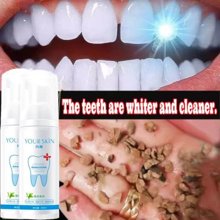 【3 Days Whitening】Teeth Whitening Mousse Remove Plaque Oral Odor ...