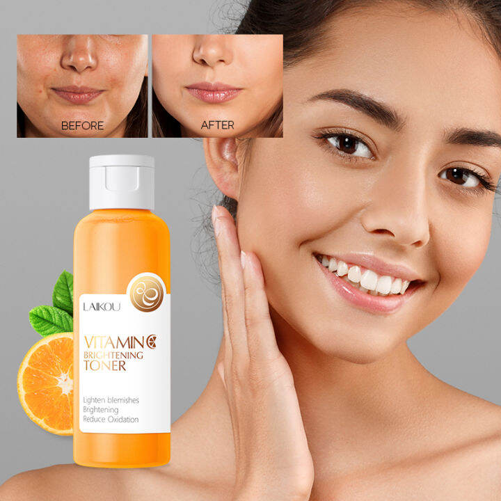 LAIKOU Vitamin C Brightening Toner Lighten Blemishes Face Care 100ml ...