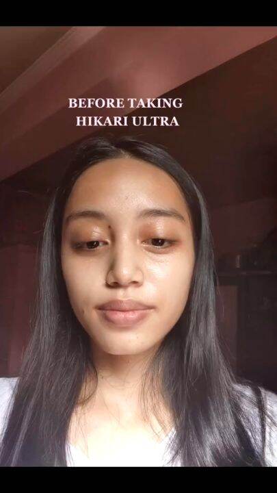 HIKARI ULTRA OTG Collagen-Infused Glutathione Capsules: The Ultimate ...