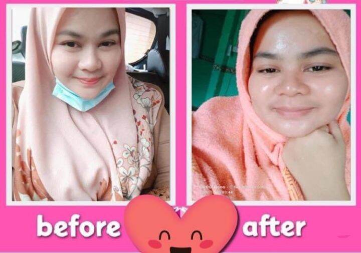 SALEP EXTRA GLOWING SUPER PELICIN BIKIN CANTIK SEPERTI KULIT CEW KOREA | Lazada Indonesia