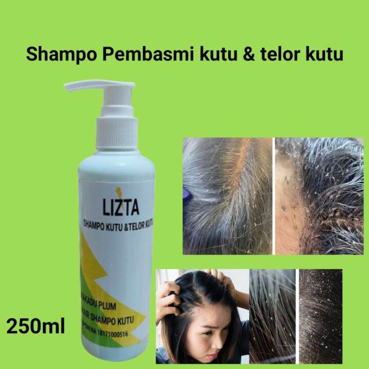 Shampo Pembasmi kutu & telor kutu 100% bersih 250ml | Lazada Indonesia