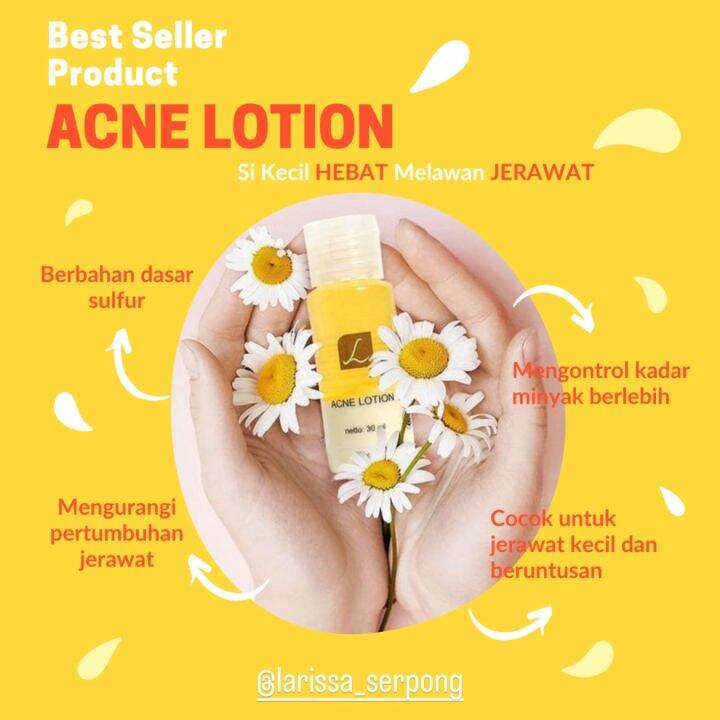 Acne Lotion Larissa | Lazada Indonesia