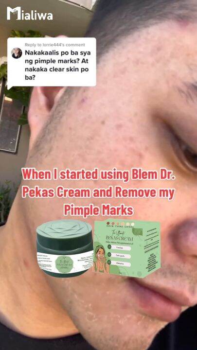Blem Dr The Ultimate Pekas Cream & Toner, Whitening Exfoliating ...