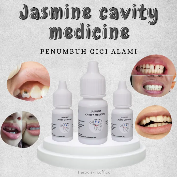 GIGI LANGSUNG TUMBUH !! PENUMBUH GIGI OMPONG, KROPOS, PATAH, BERLUBANG ...
