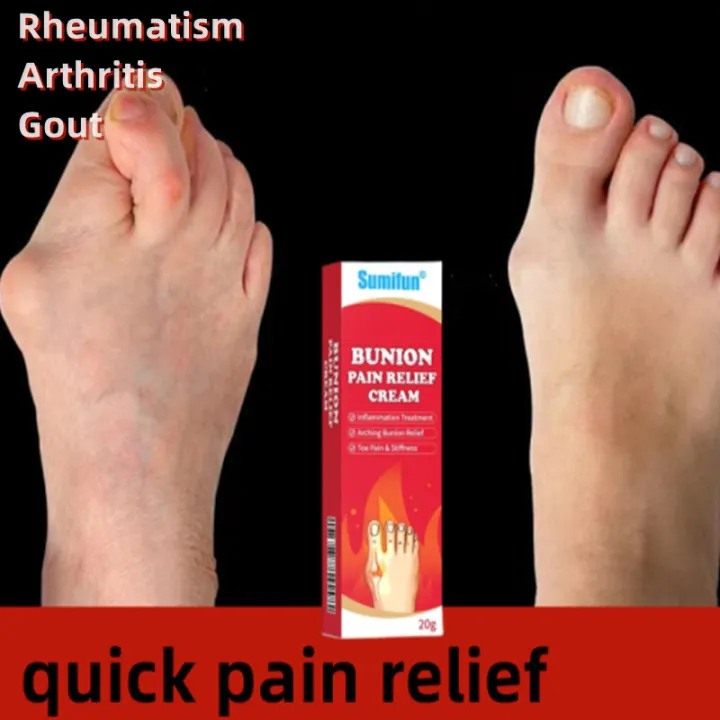 Bunion pain cream rheumatic plaster gout cream Joint pain cream Relief ...