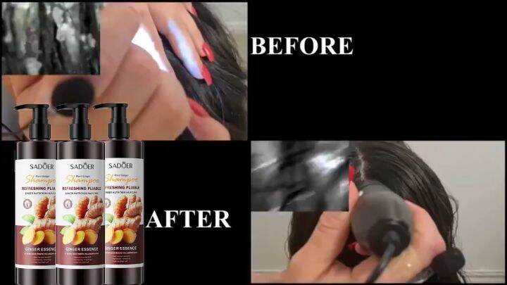 500ml Syampoo Rambut Gugur Ginger Dandruff Shampoo Kelemumur Hair Serum