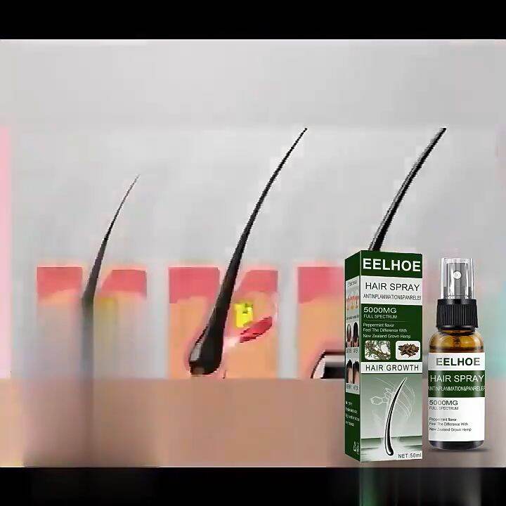 EELHOE Hair Growth Essence Spray Anti-alopecia No stimulation Scalp ...