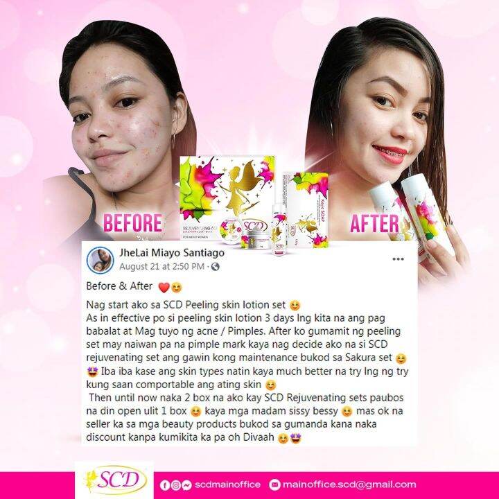 Original SCD Rejuvenating Set | Lazada PH