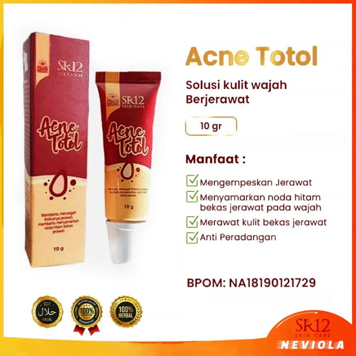 Acne Cream Totol SR12 - Solusi Ampuh Mengatasi Jerawat | Lazada Indonesia