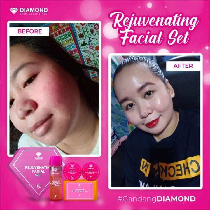 DIAMOND REJUVENATING SET ORIGINAL WITH FREEBIES | Lazada PH
