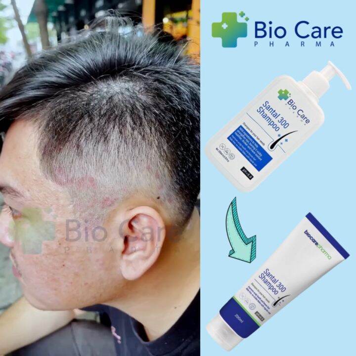 Dầu Gội Thảo Dược Biocare Pharma Santa 300 Shampoo (200ml) Chính Hãng ...