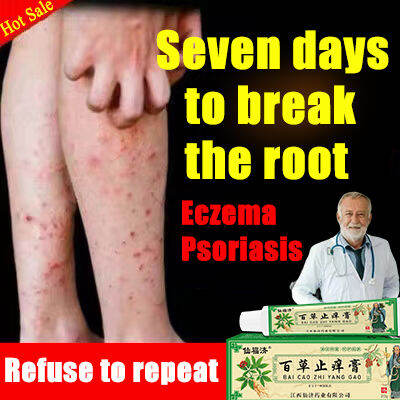 Antibacterial Ointment 20g Cream Fungal Infection Itchy Skin Relief ...
