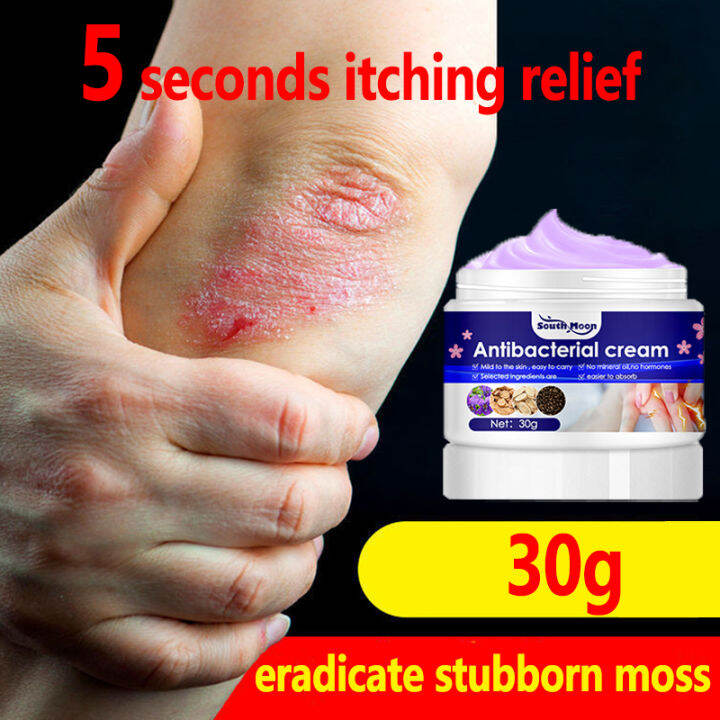Antibacterial cream 30g Skin Rash Cream Skin Herbal Psoriasis ...