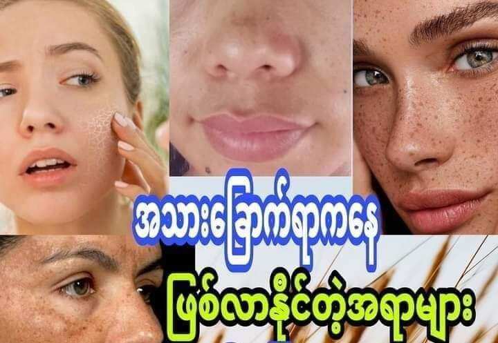 Sor နေကာ အောက်ခံ ပြာခြင်းကွက်ခြင်းမရှိ Lazada