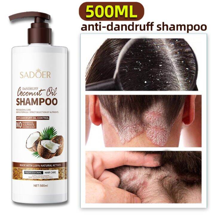 SADOER Coconut Oil Moisturizing Anti Dandruff Shampoo Deep cleaning, get rid of dandruff, anti ...