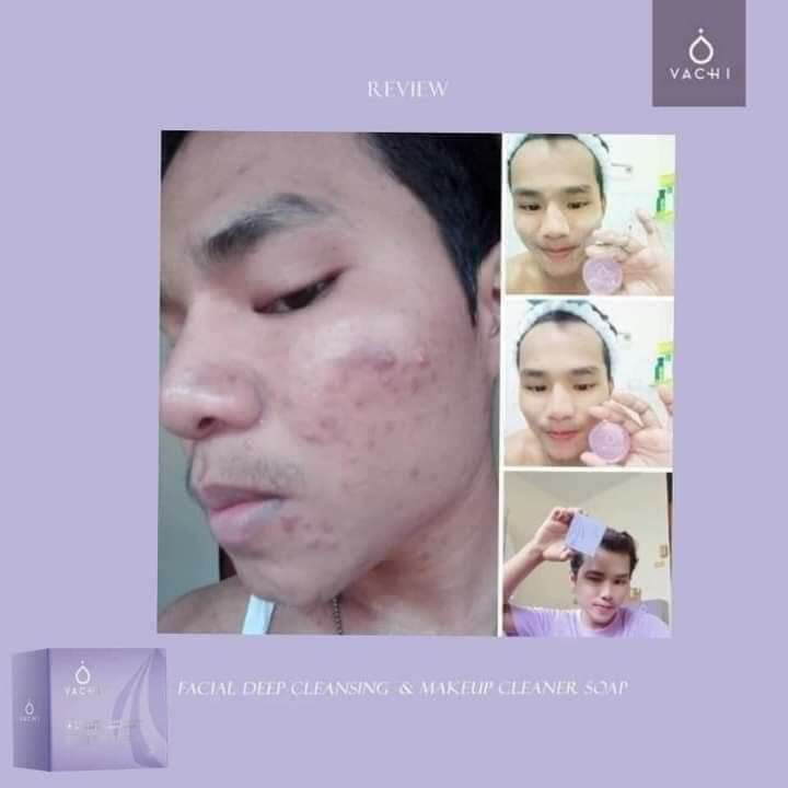 Vachi Soap ကို ဘာလို့ မ်က္ႏွာျဖဴဆပ္ျပာလို့ ေခၚတာလဲ သူေလးက Vitamins 4မ်ိ ...