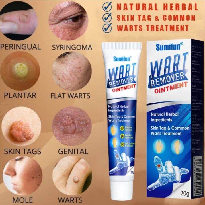 Clara.Warts Remover Original Cream Warts Magic Remover Warts Remover ...