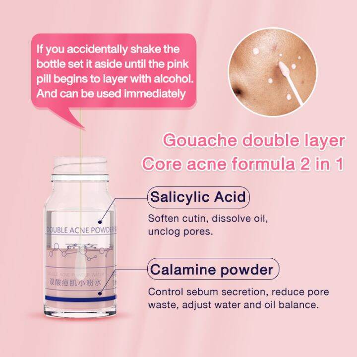 Salicylic Acid Acne Drying Lotion 10ml double acne powder water Acne ...