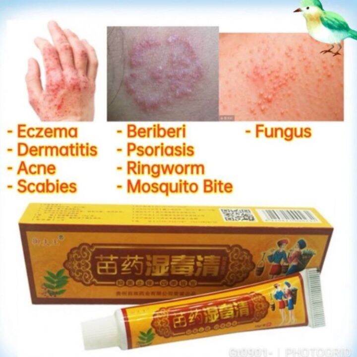 Herbal Cream Ubat Gatal Kurap Kayap🇲🇾苗药湿毒清 湿疹 牛皮癣 | Lazada