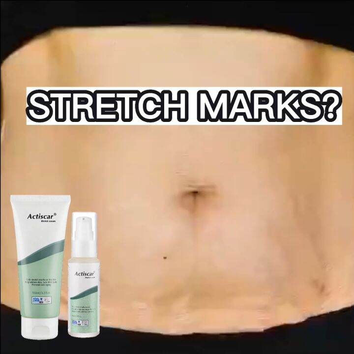 Actiscar Stretch Removal Cream 100ml Fade Stretch Marks For Pregnant ...