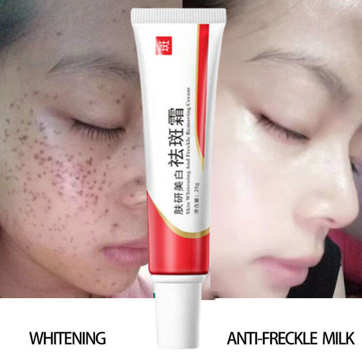 Original Pekas Remover 100% Effective and Original Whitening Freckle ...