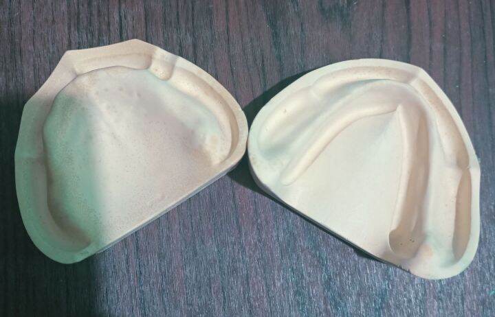 Edentulous Cast | Lazada PH