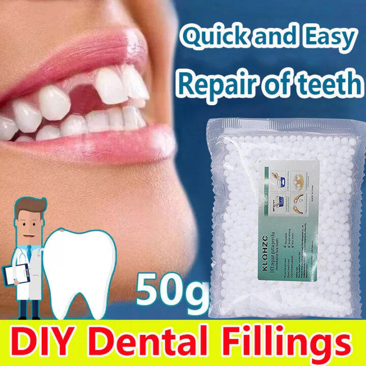 【1 second bonding】DIY Tooth Repair Kit Temporary Tooth Repair kit 50g ...