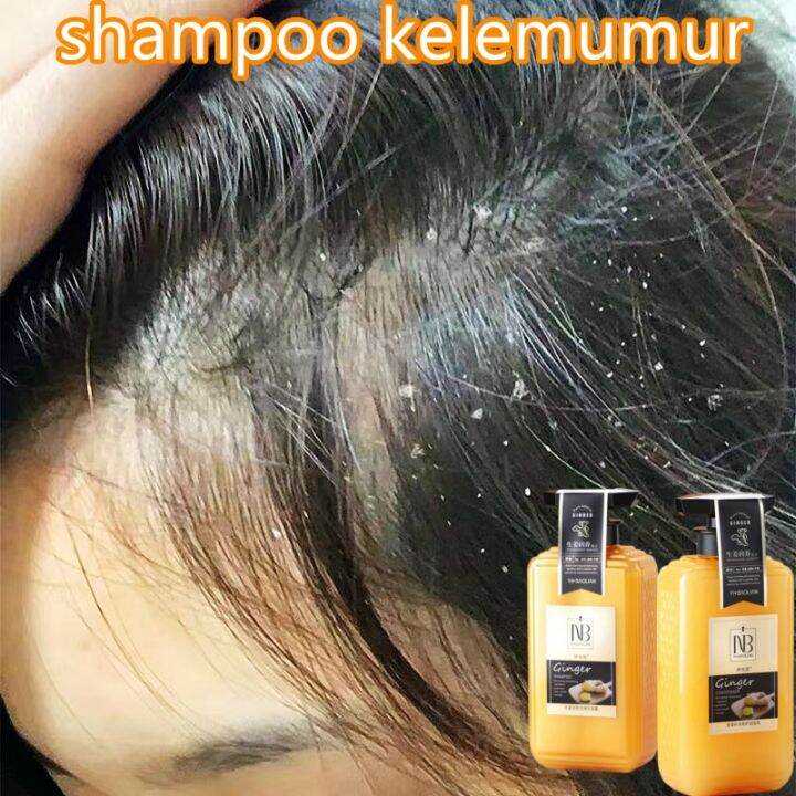 Shampoo Kelemumur Anti Dandruff Shampoo Ubat Kelemumur Kepala Syampu