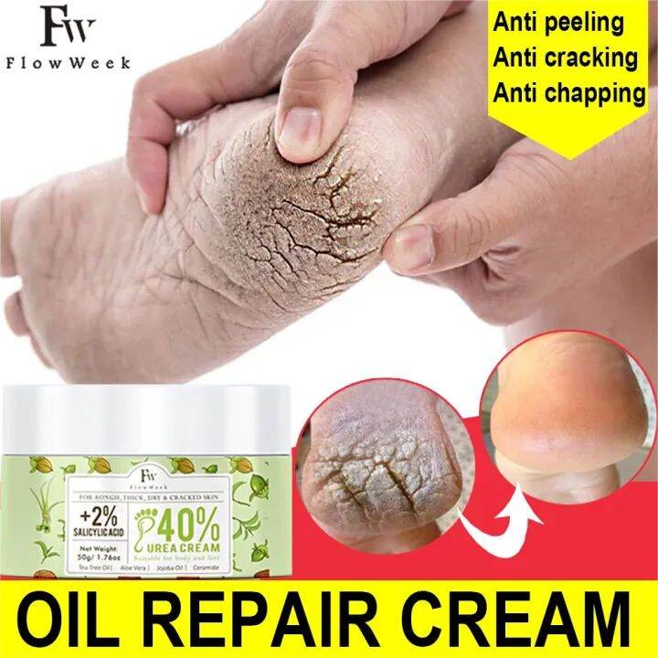 Flow Week 40% Urea Cream Heel Cracked Repair Cream Removes Dead Skin ...
