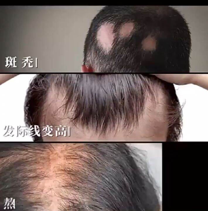 AZLA Ginger Hair Grower Shampoo Anti-Hair Loss Anti-Dandruff Fast ...