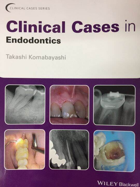 Clinical Cases in Endodontics | Lazada