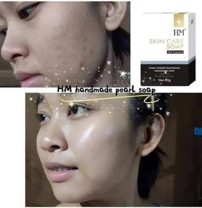 Hm Skincare Soap สบู่ผิวขาว ใช้ได้ทั้งผิวหน้าและผิวกาย 💗สบู่ผิวขาว ผิว ...