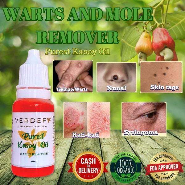 Organic & Authentic Verdefy Purest Kasoy Oil. Best Remover of Mole ...
