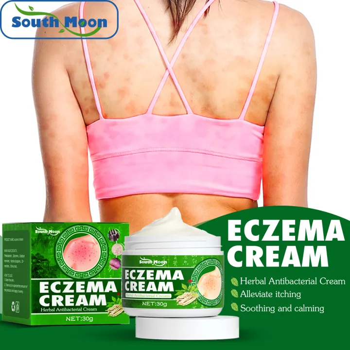 South Moon Eczema Cream Herbal Antibacterial Cream Skin Psoriasis Cream
