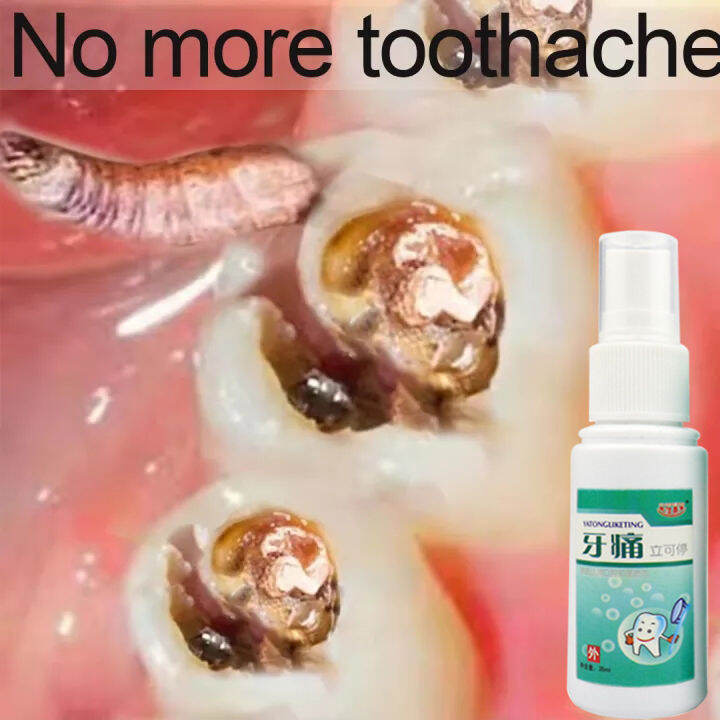 Toothache Spray 35ml Fast Pain Relief Plant Extracts Hormone Free ...