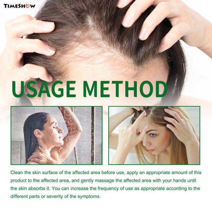 TimeShow Plant Formula Hair Follicle Cream Body Antipruritic Hair ...