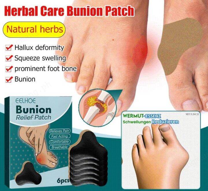 fengmang 【Recommended by Orthopedic Doctor】EELHOE Bunion Patch | Lazada PH