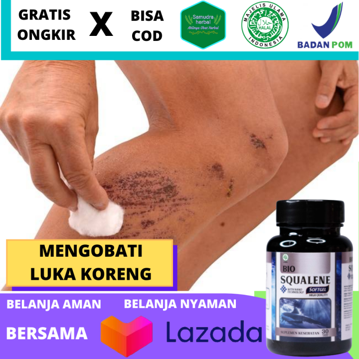 Obat Korengan, Luka Koreng Di Tangan, Kaki, Borok, Budug, Cacar, Bisul ...